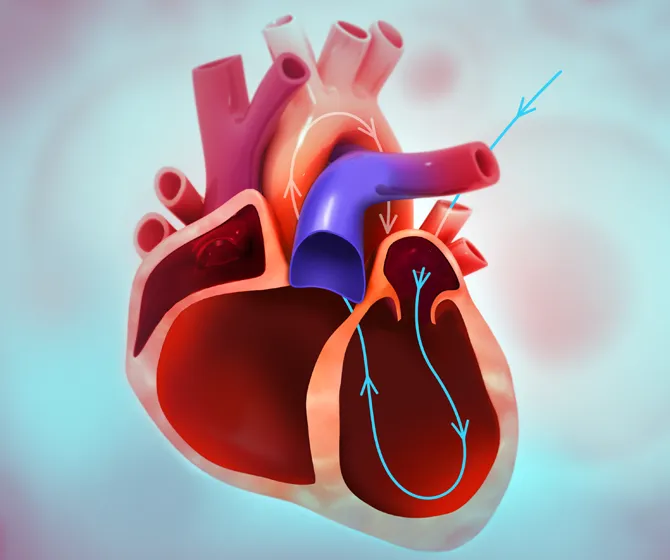 Dr Lei Fan: Computational Modeling and the Working Heart | ADInstruments